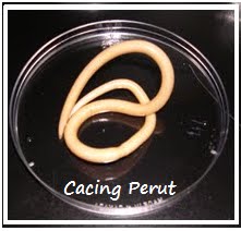 BIOLOGI GONZAGA: CACING PERUT-ASCARIS LUMBRICOIDES