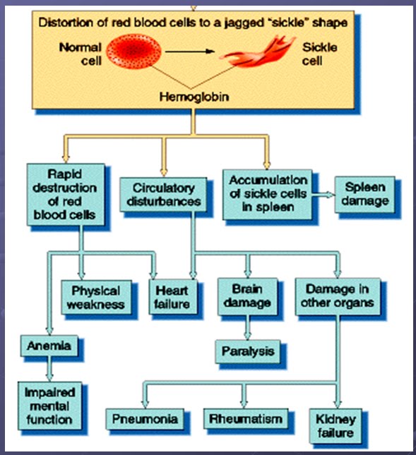 BIOLOGI GONZAGA: SICKLEMIA