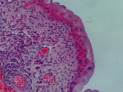 Histologia dos Sistemas: Bexiga
