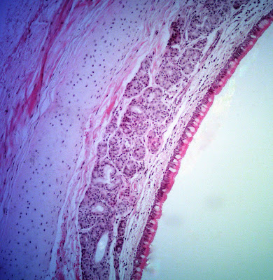 Morfologia: Traquéia