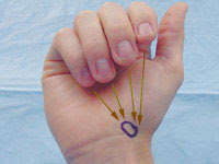 Medical Mnemonics 4U: Memory and Study aids for Medical Students