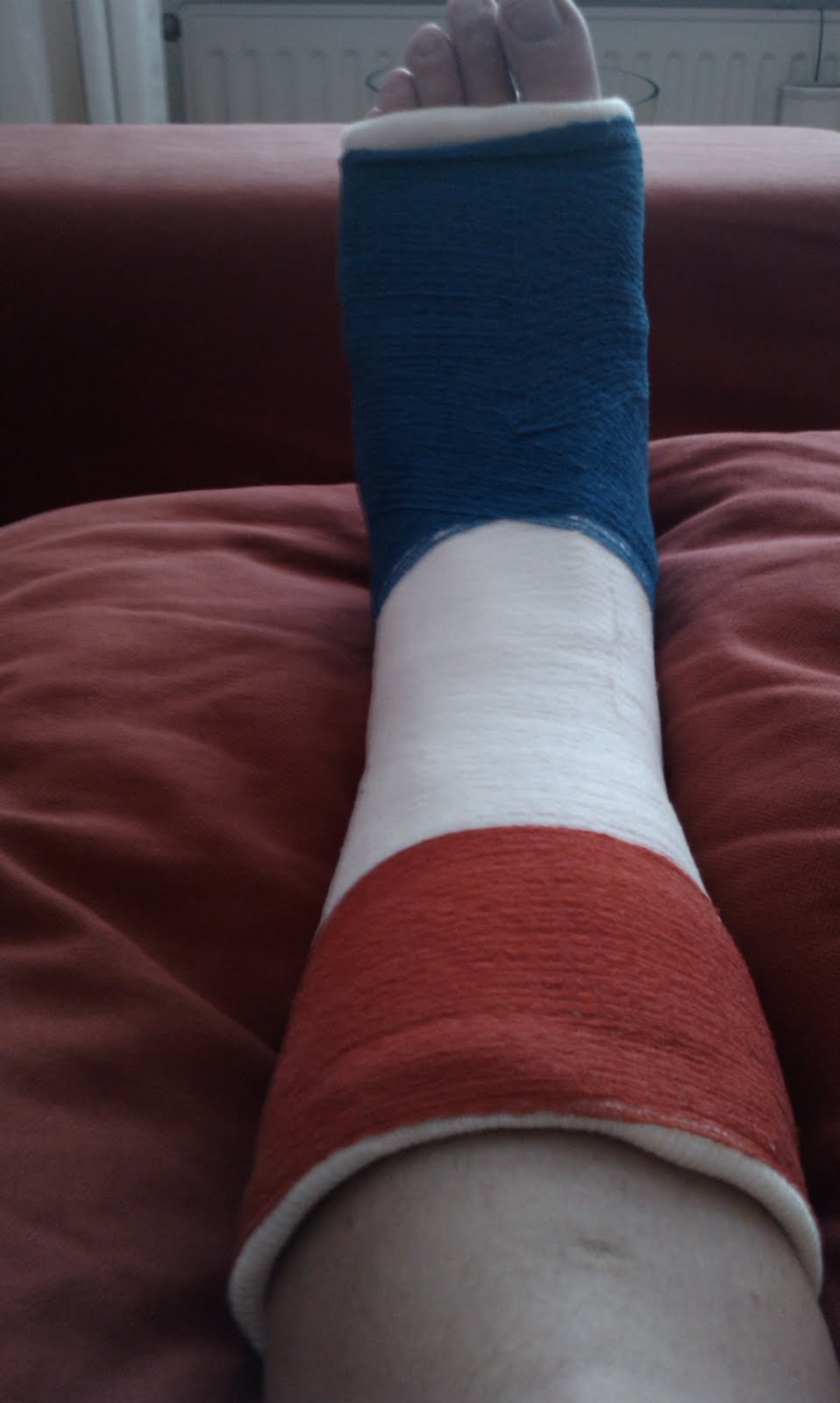 Calcaneus blog: geen oranje gips
