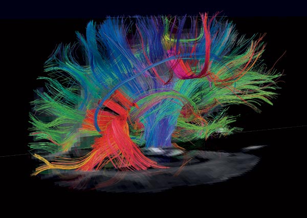 fiber tractography : dataisbeautiful