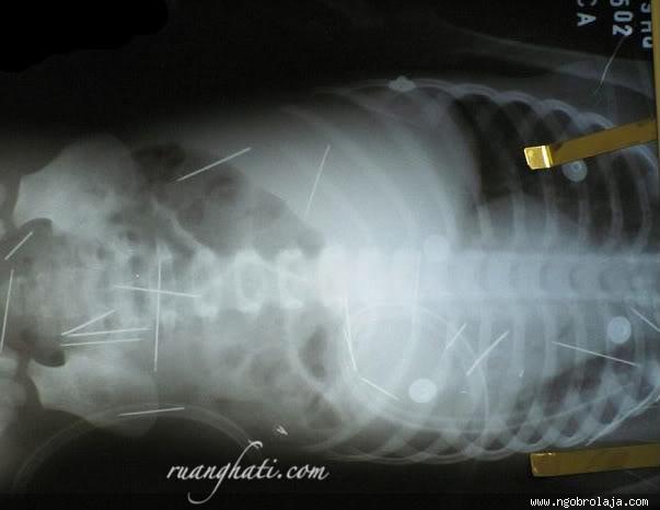 TUKANG RONTGEN BLOG'S: Astaga!! Hasil Rontgen di Perut Bayi 2 Tahun ...