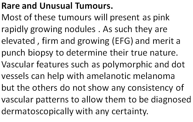 Dermoscopy Made Simple: Haemangioma and Angiokeratoma