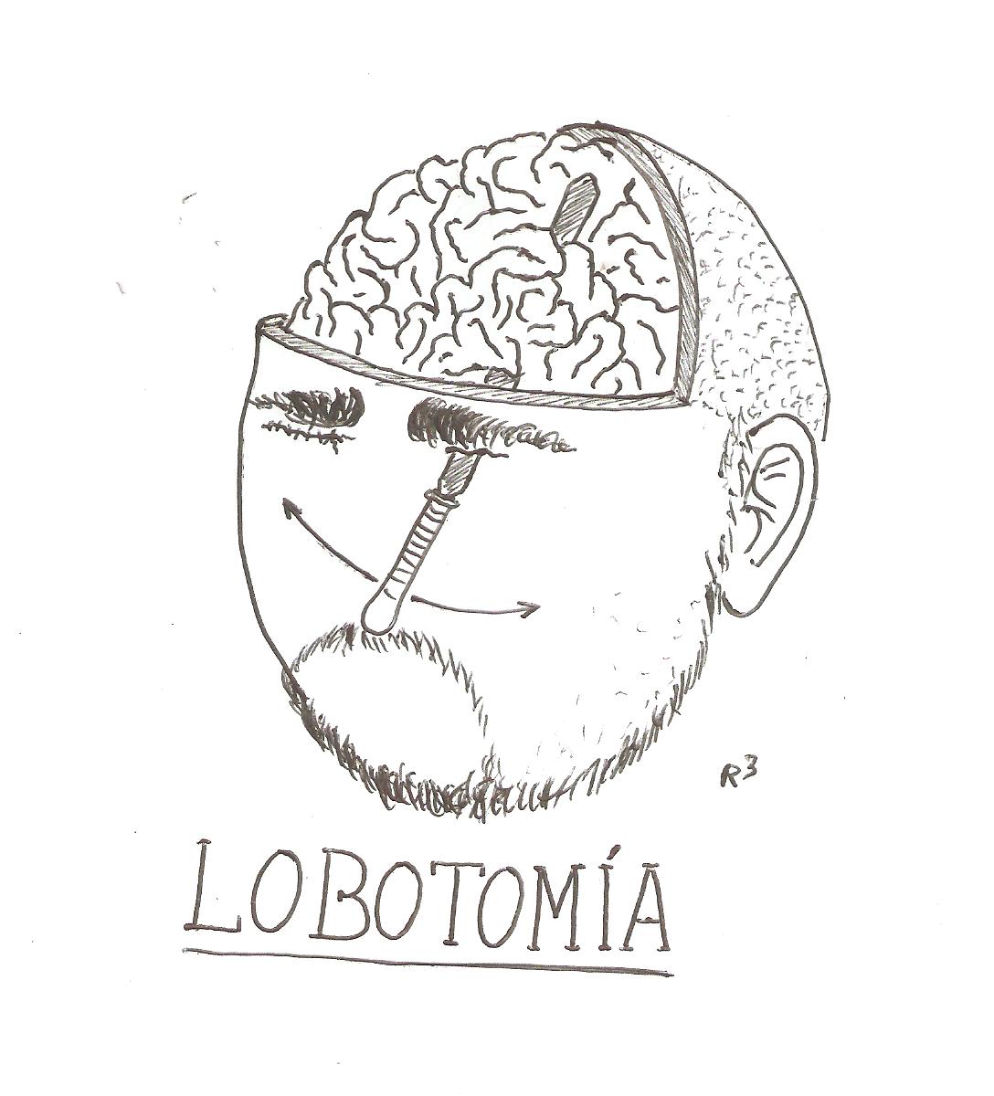 R3 and his PEN!!: Lobotomía...