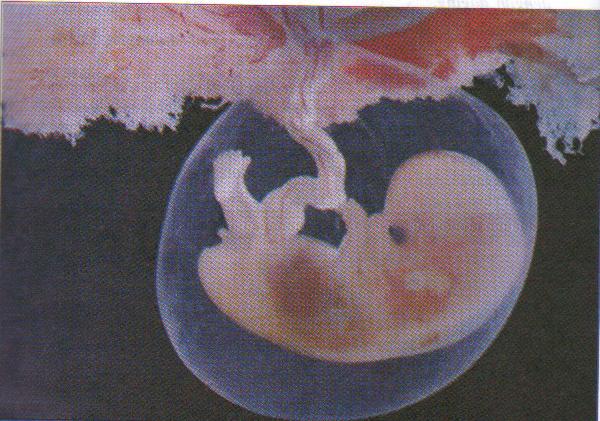 Sains Dan Islam: PROSES KEJADIAN MANUSIA MENURUT AL-QURAN