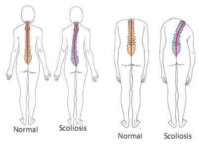 Clinical Examination of the Spine - IVLine