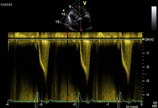 Echocardiogram Untuk Penolong Pegawai Perubatan ( Pembantu Perubatan )