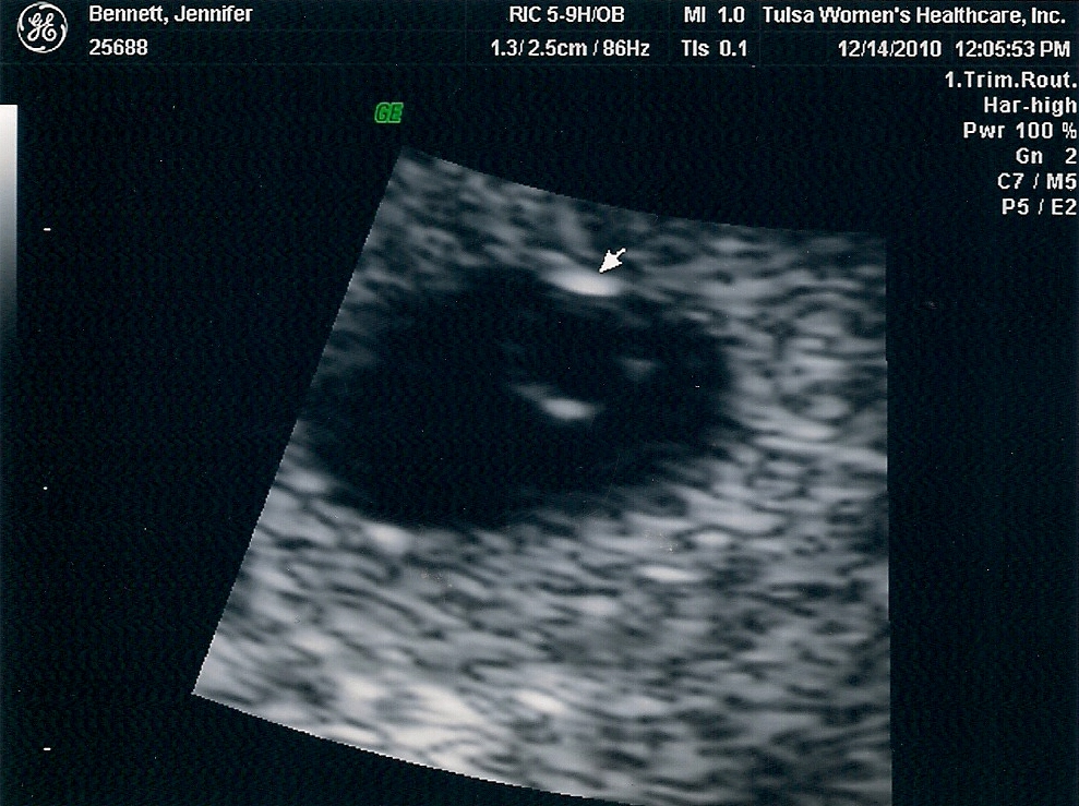 The Bennett Life: First Ultrasound