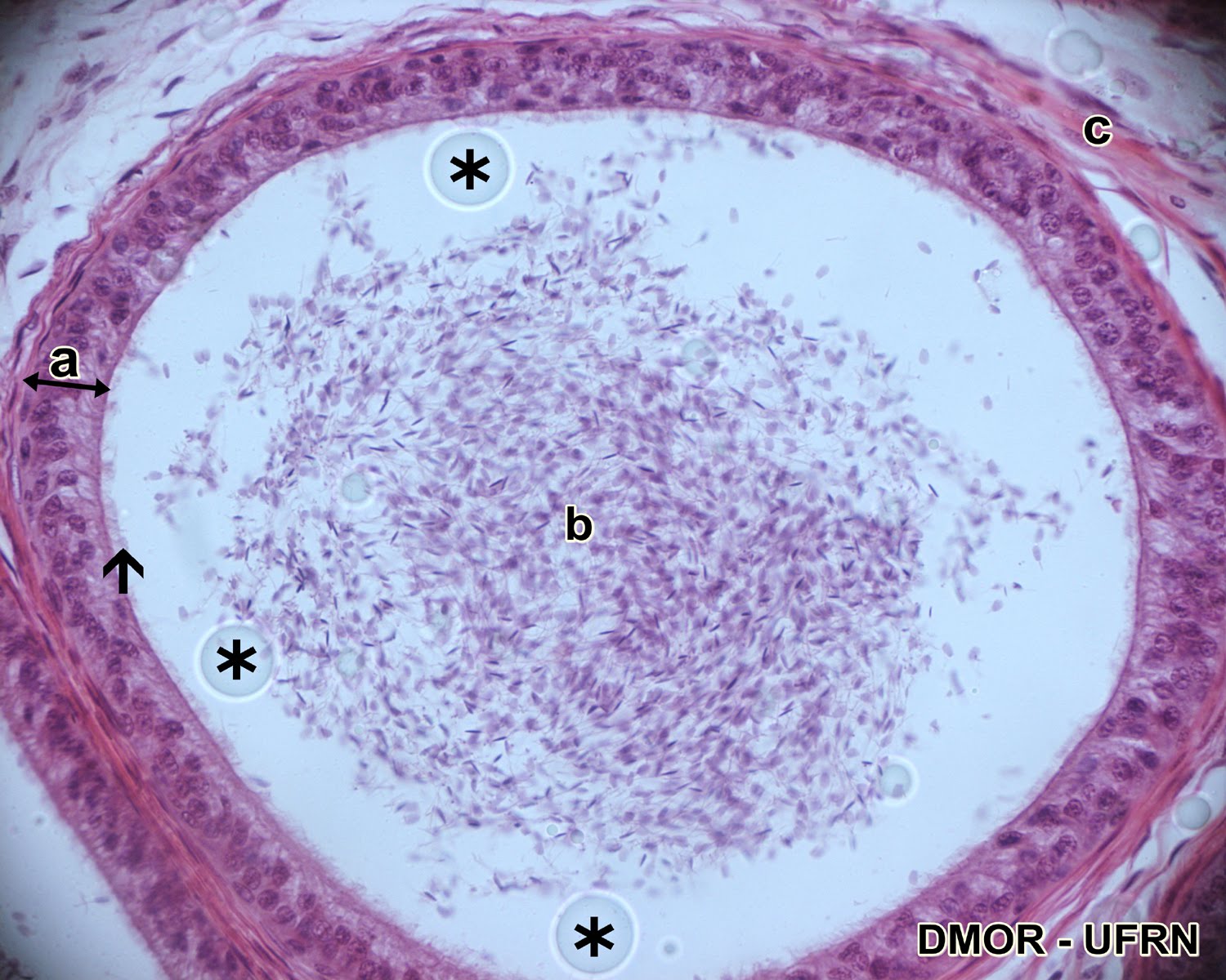 Ciências Morfológicas - UFRN: Sistema Reprodutor Masculino