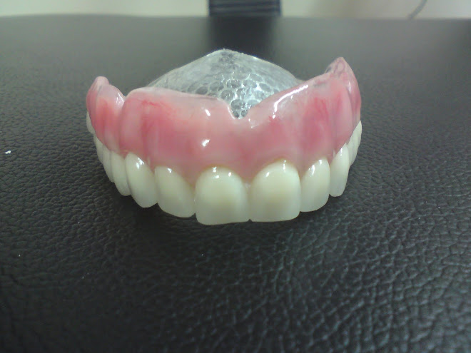 Prótese Total Estética Odontológica P&L