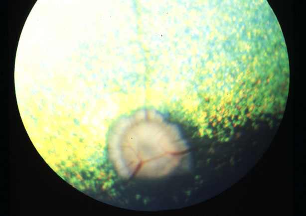 DEGENERAZIONE/ATROFIA/PROGRESSIVA DELLA RETINA ( PRA PROGRESSIVE ...