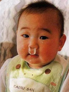 Funny Pictures: Baby Snot Funny Picture
