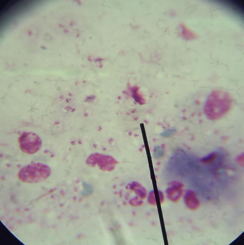 Parasitologia: Protozoários Tripanosomatídeos