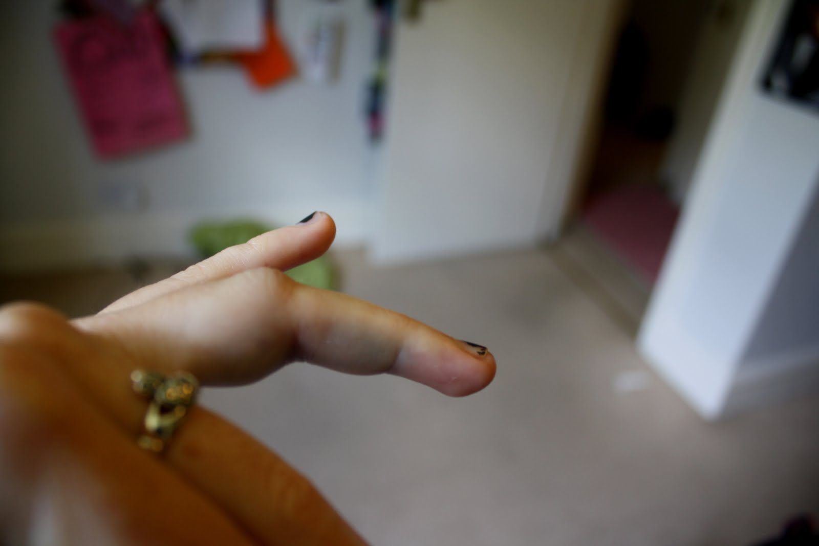 zombie finger | red, white, but not blue