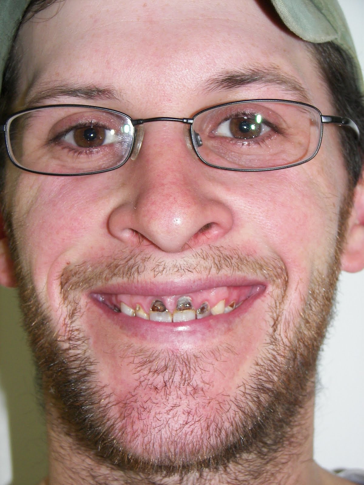 Dental Reflections Blog: Dr.Kaloti Extreme Dental Makeover Winner ...