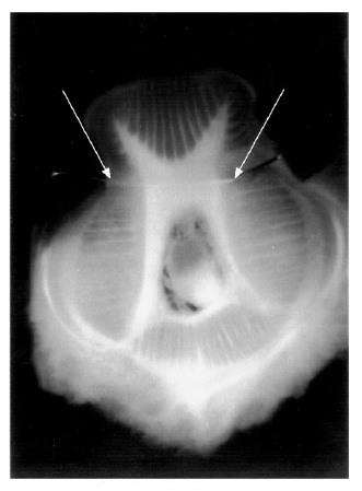 Cephalove: Neuromuscular Dynamics of Octopus Arm Movements