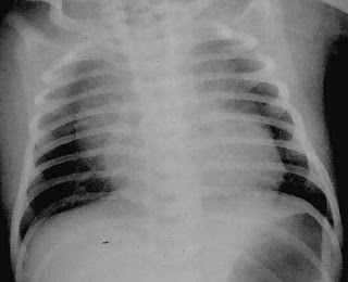 O Guia do Fisioterapeuta: Radiografia pediatrica - O que observar em um ...