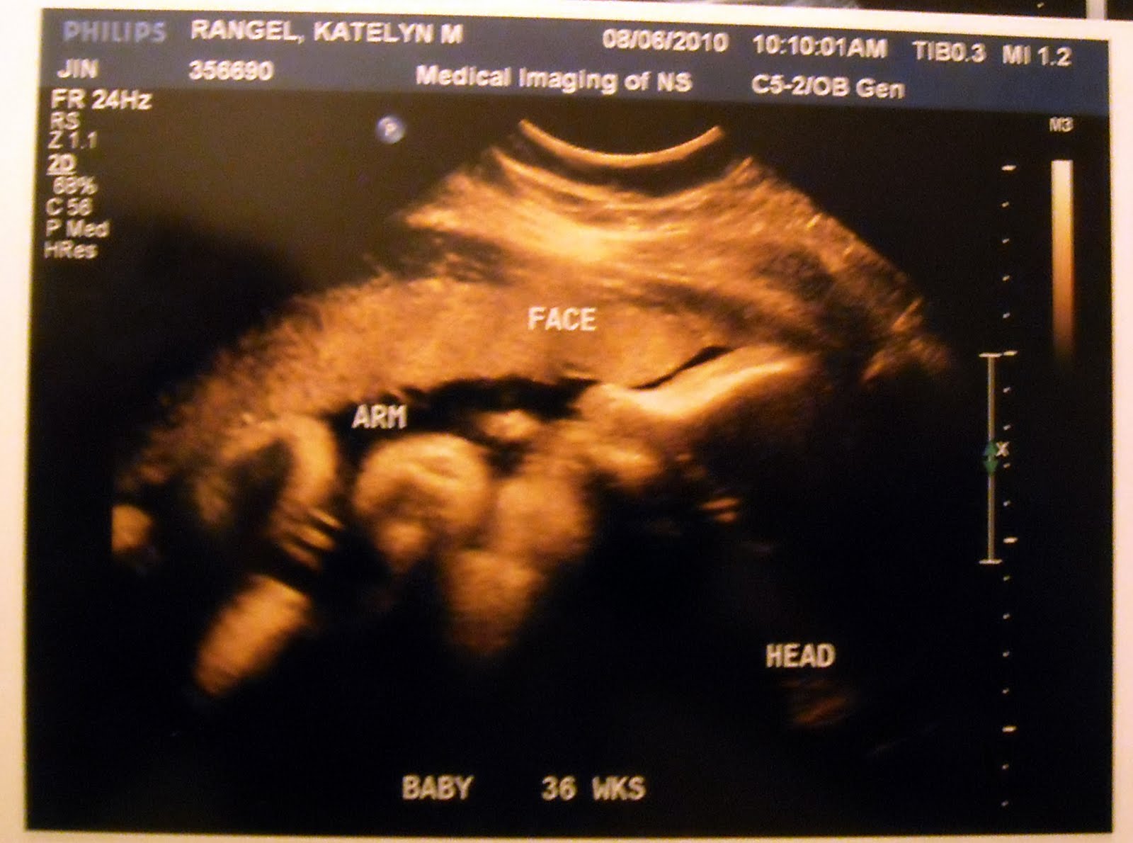 The Rangel's: 36 Week Ultrasound