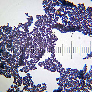 Medical Knowledge: Staphylococcus (gram positive bacteria)