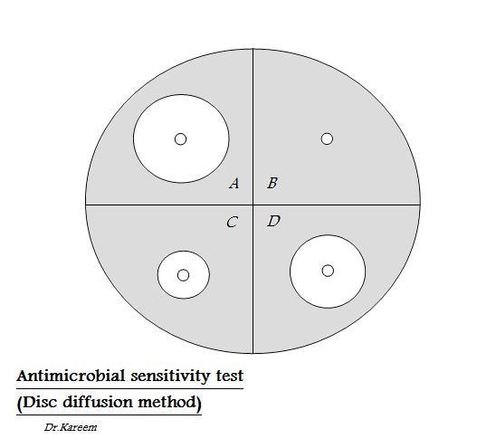 ERU_Microbiology & Immunology Dept.: Antimicrobial sensitivity test