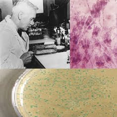 English Class Level One: THE DISCOVERY OF THE PENICILLIN (1928):