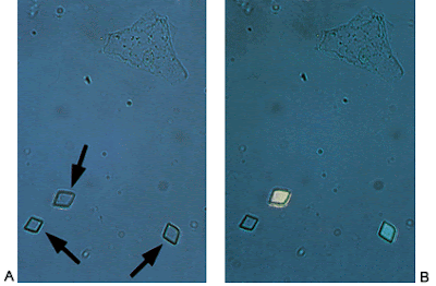 LAB PATOLOGI KLINIK: Urinalysis (sedimen)