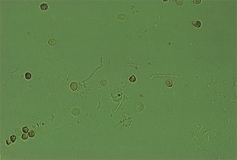 LAB PATOLOGI KLINIK: Urinalysis (sedimen)