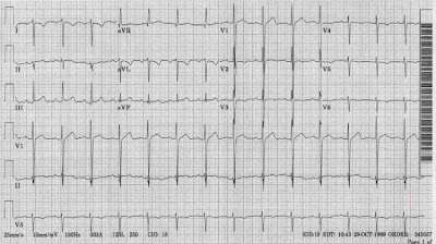 Dextrocardia | Paramedicine 101