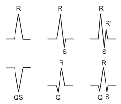 The Electrocardiogram - Part IV | Paramedicine 101