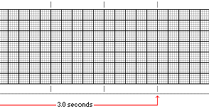 The Electrocardiogram - Part II | Paramedicine 101