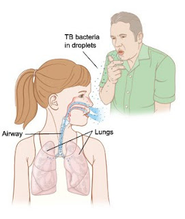 SF TB: How does TB Spread?