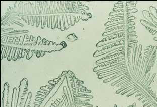 gynaecology and obstetrics: Ferning and spinnbarkeit tests for ovulation