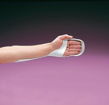 OCCUPATIONAL THERAPY ; SPLINTING: Variety of Splint