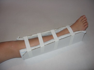 Living Active: Fitness Fear Friday - Shin Splints & Hot 100