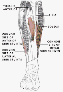 Living Active: Fitness Fear Friday - Shin Splints & Hot 100