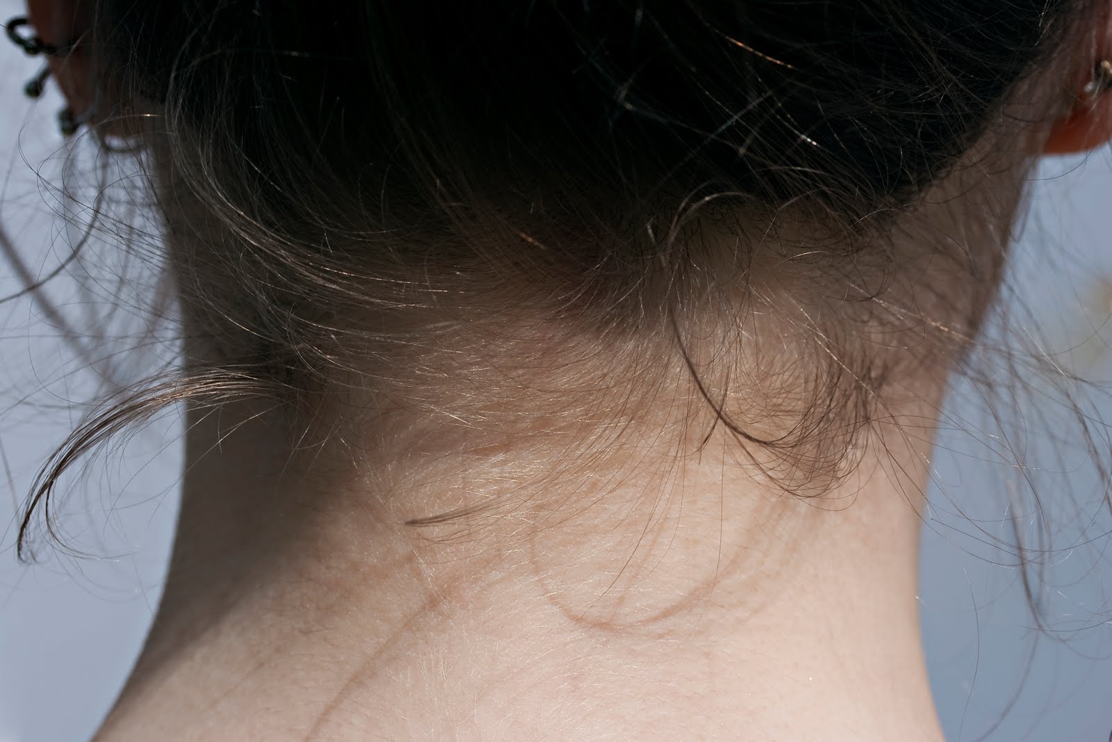 Peter Marley | Paradox Pictures Photography: Somebody [Part V]: Nape