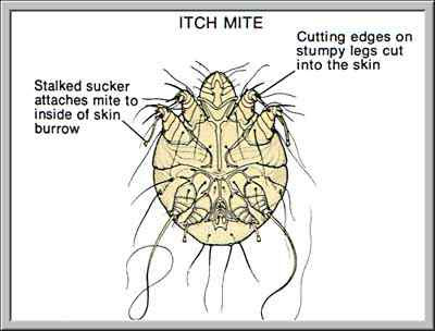 FirstPageNews: Itch Mite : Treatements and precautions