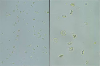 Junaid Mohamed: Microscopic Examination Of Urine