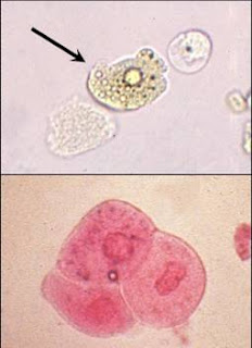 Junaid Mohamed: Microscopic Examination Of Urine