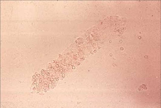 Junaid Mohamed: Microscopic Examination Of Urine