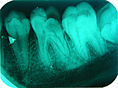 Restorative Dentistry & Endodontics