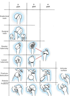 11:50: Clasificación de Neer