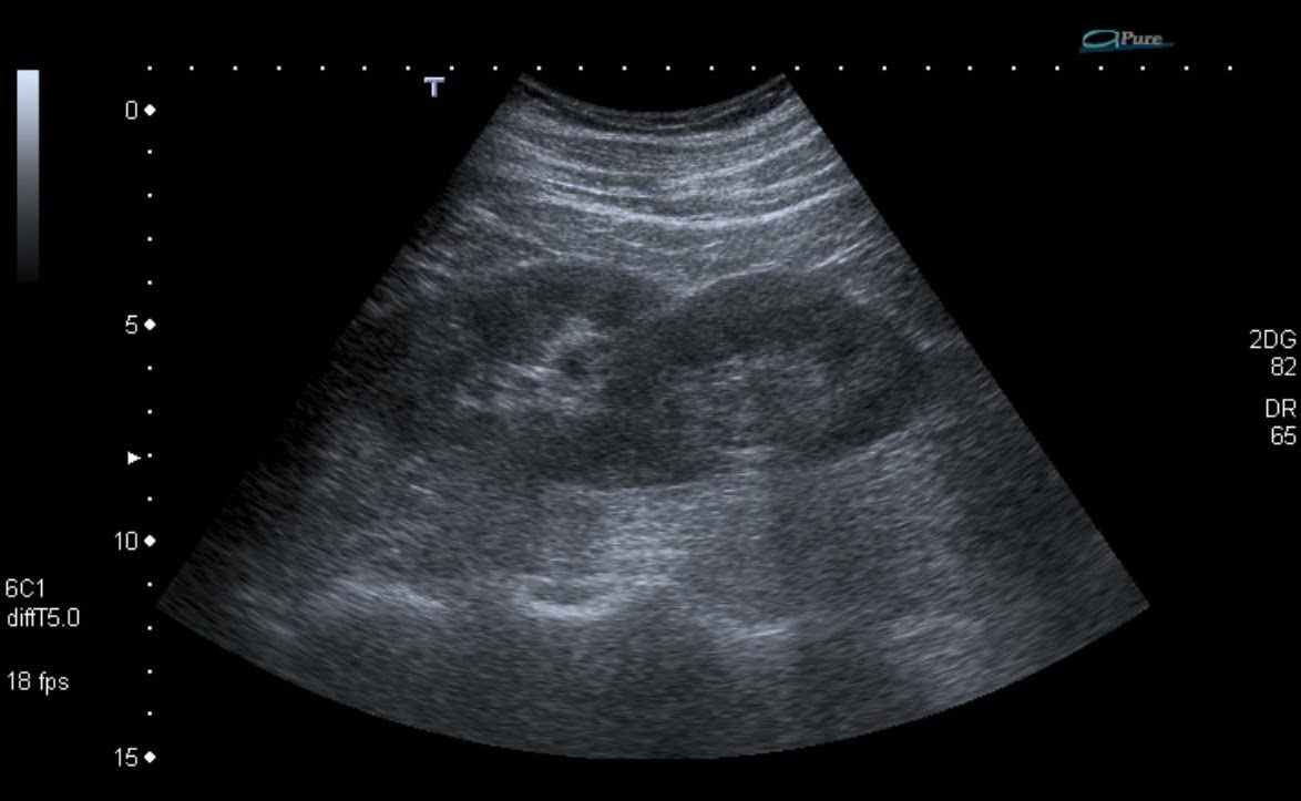 What have we learned today: Duplicated collecting system