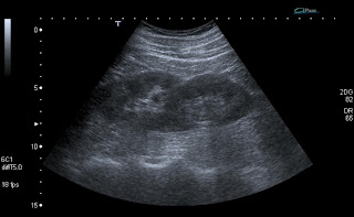 What have we learned today: Duplicated collecting system