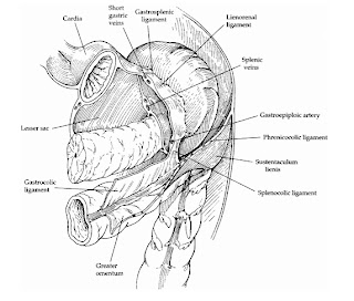 surgical operations: Laparoscopic Splenectomy