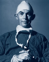 Conta-me como era...: Christian Barnard