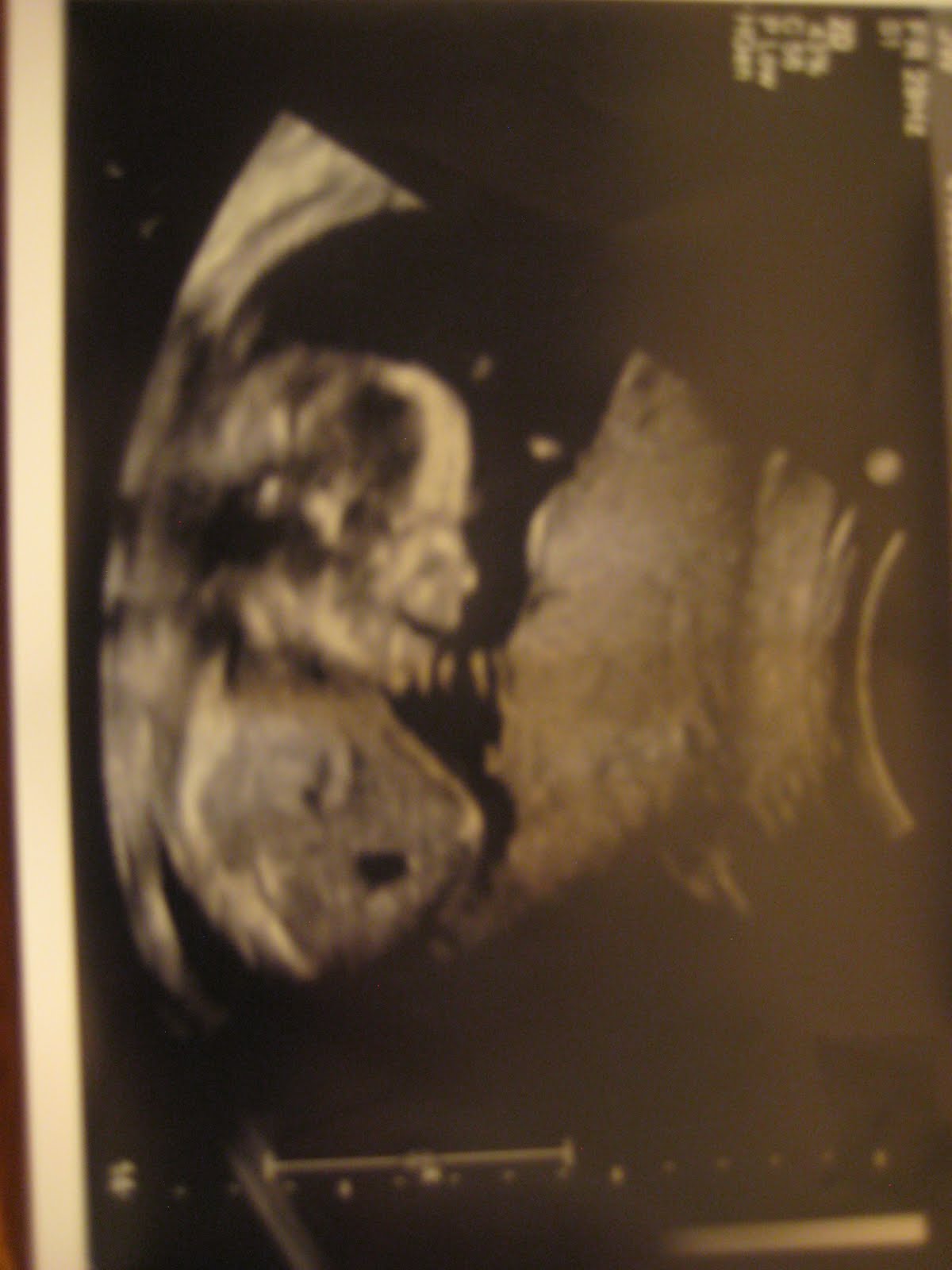 The Davis Family: 21 weeks and an Ultrasound!
