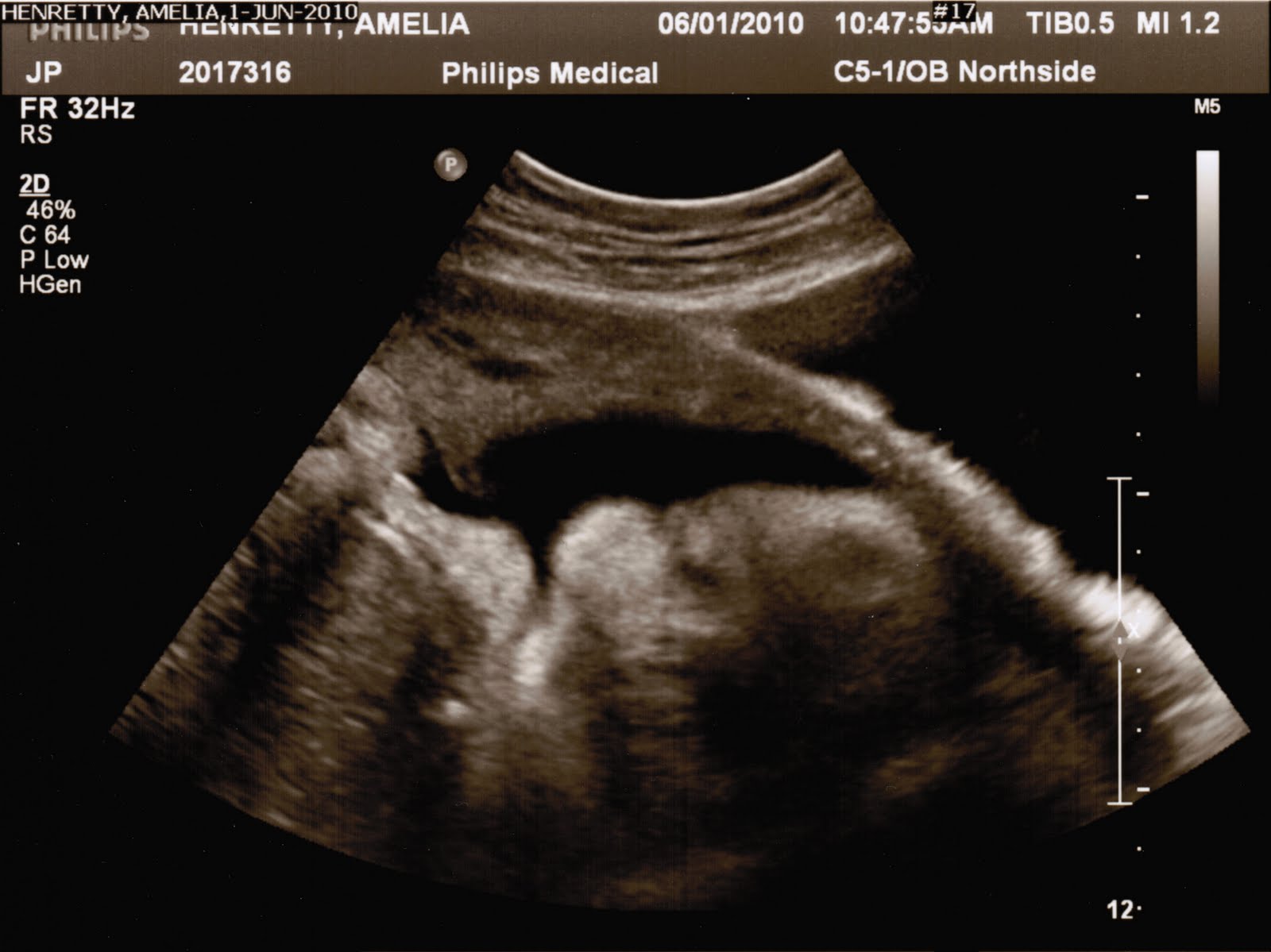 Henretty Happenings: Ultrasound pictures - 31 weeks